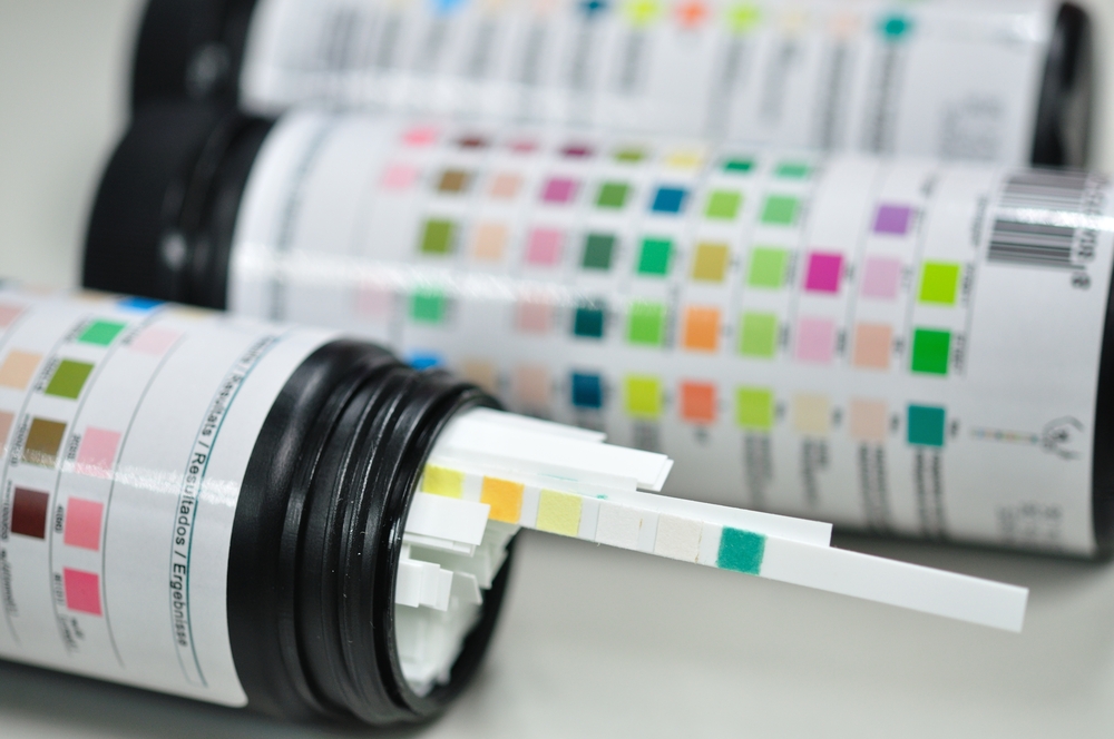 4 Ways the Drug Screening Process Has Improved – For Employers AND ...
